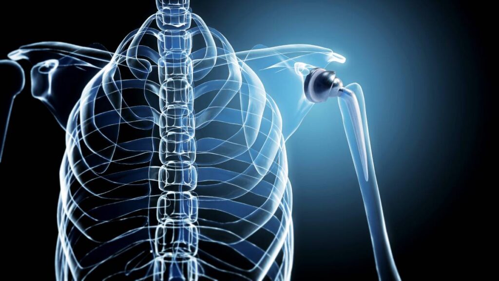 RADIUS ANESTHESIA OF TEXAS